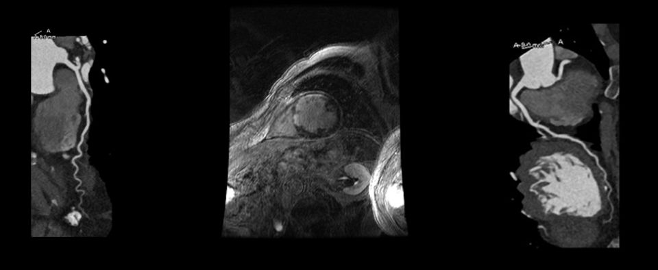 Cardiac Non-Invasive Imaging and Testing | Cardiology | Weill Cornell ...